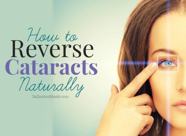 Reverse Cataracts Naturally